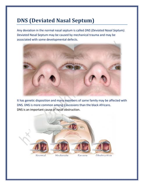 Examination of nose | PPT