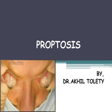 PROPTOSIS | PPTX