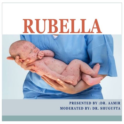 RUBELLA | PPTX