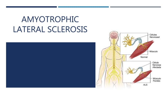 Amyotrophic Lateral Sclerosis | PPT