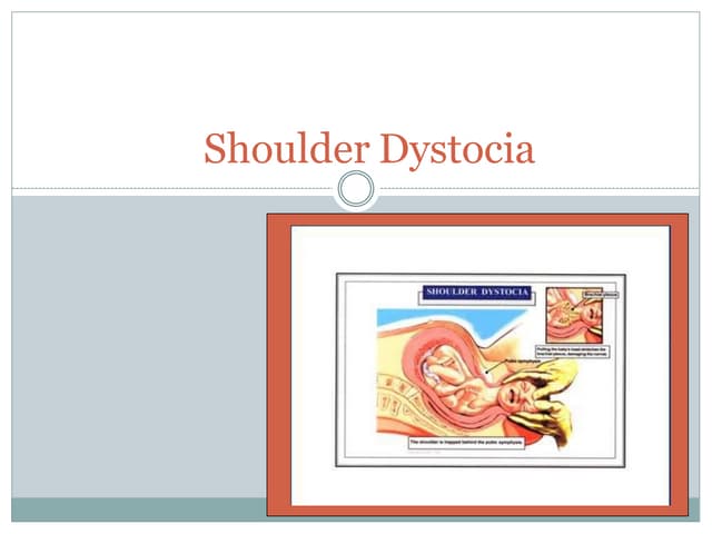 shoulder Dystocia.pptx
