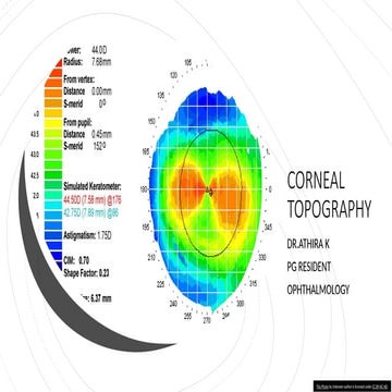 Corneal Topography | PPT