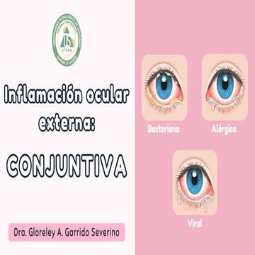 Patología de la conjuntiva. | PPTX