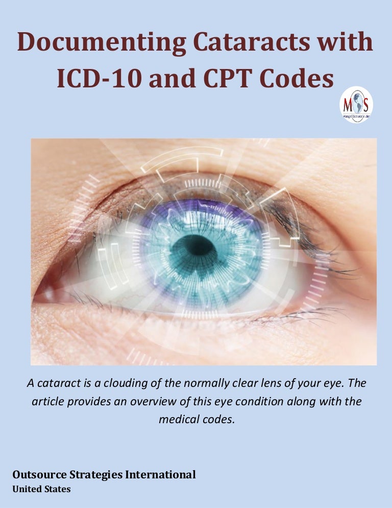 Documenting Cataracts With ICD 10 And CPT Codes documenting-cataracts-with-icd-10-and-cpt-codes