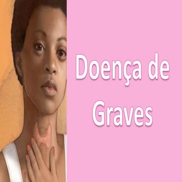 Doença de Graves | PPTX