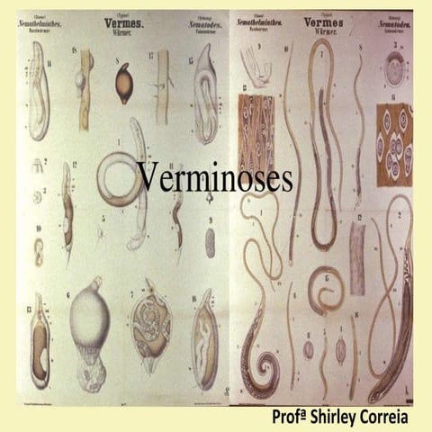 Doenças causadas por vermes | PPTX