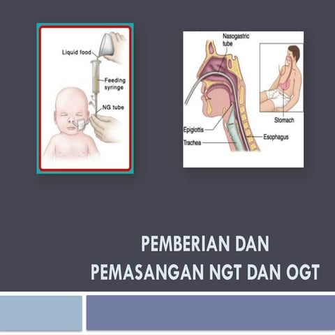 prosedur pemasangan nasogastric tube dan OGT | PPTX