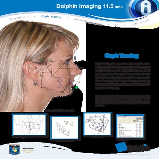 Dolphin Ceph Tracing Tool | PDF