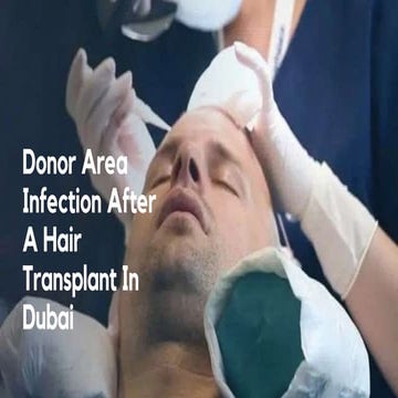 Donor Area Infection After A Hair Transplant In Dubai.pptx