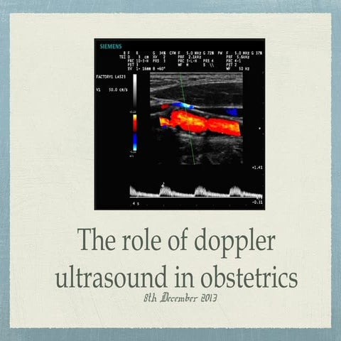 Doppler | PPT