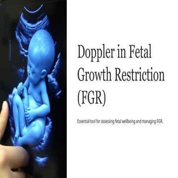 Doppler-in-Fetal-Growth-Restriction-FGR.pptx