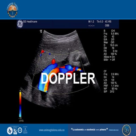 Doppler medios diagnostico y cuidados de enfermeria | PPTX