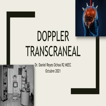 Doppler transcraneal.pptx