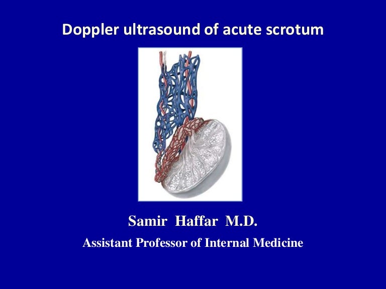 Doppler Ultrasound Of Acute Scrotum 