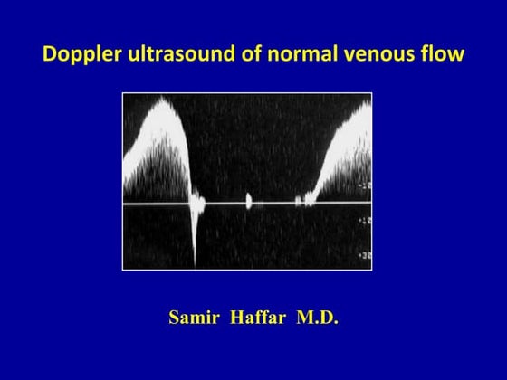 Detecting Deep Venous Disease with Duplex Ultrasound | PPT