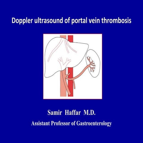 Doppler ultrasound of the portal system - Normal findings | PPTX