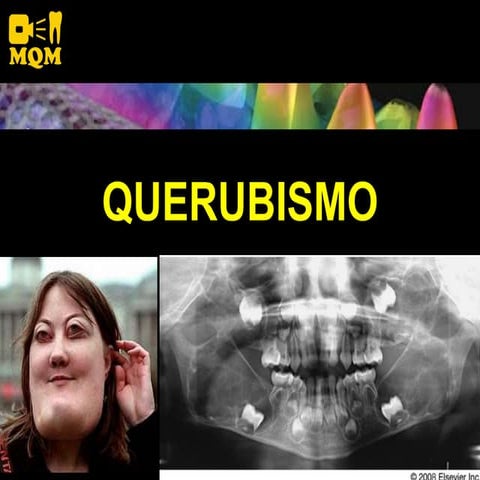 QUERUBISMO | PDF