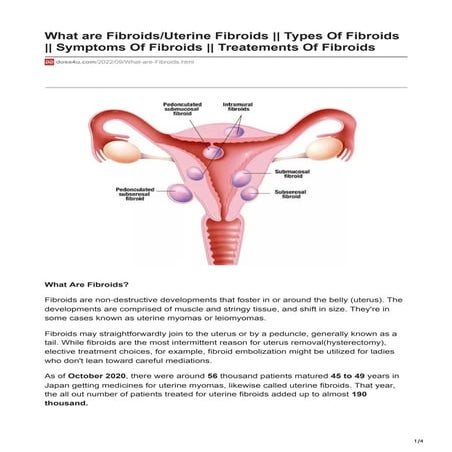 What are Uterine Fibroids? | PDF