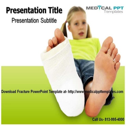 Fracture PowerPoint Template- Medical PPT Templates | PPTX