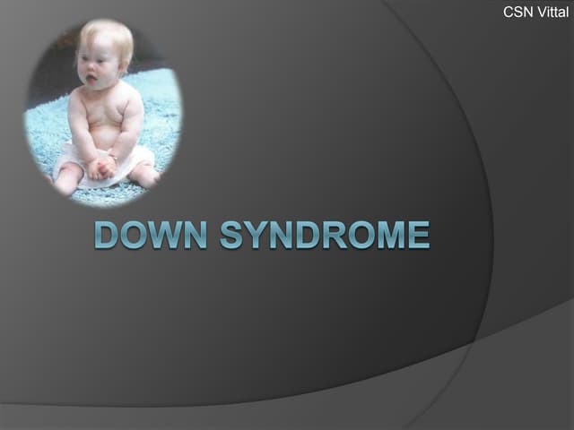 Down syndrome | PPTX
