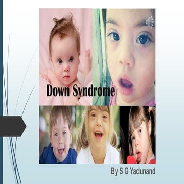 Down syndrome | PPTX