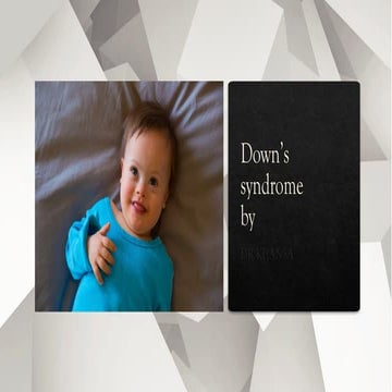 Down syndrome. pdf diagnosis and screening by DR. Khansa | PPTX