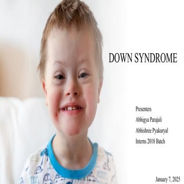 Down syndrome. Mechanism, Investigation, Treatment, Dermatoglyphic ...