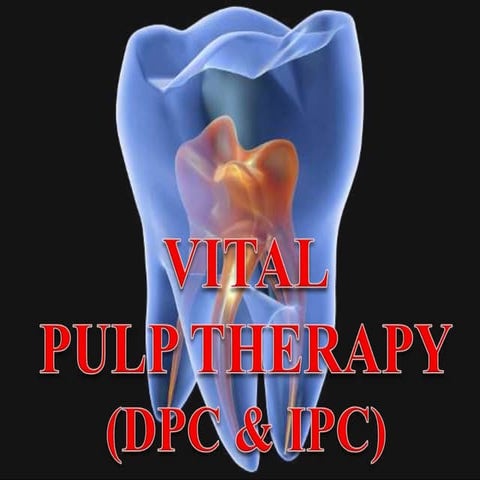 VITAL PULP THERAPY | PPTX