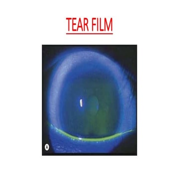 Dr. reema thomas 12 1-17 tear film | PPTX