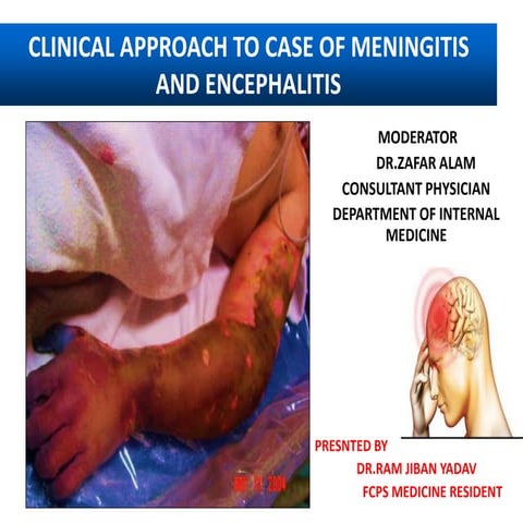 DR. RAM JIBAN MENINGITIS PPT FINAL.pptx gds | PPT