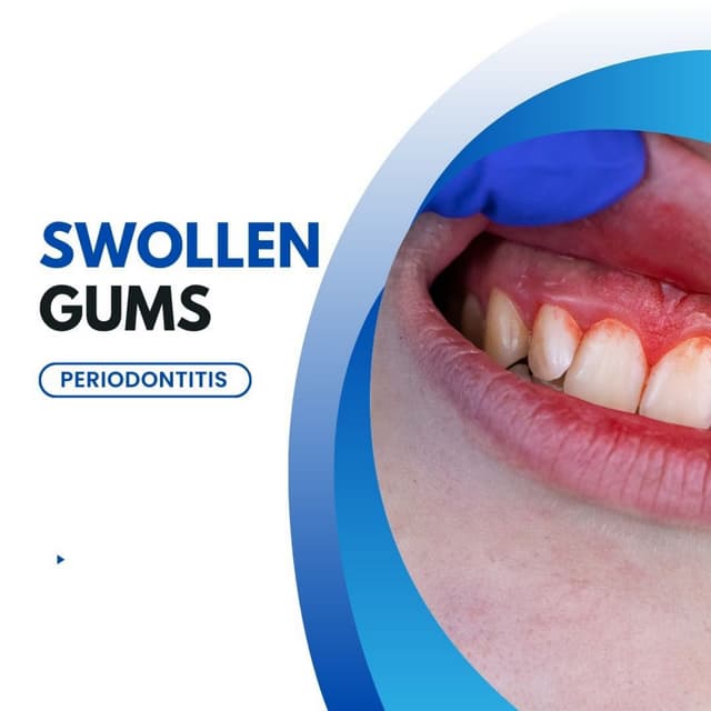 Healthy gums should be firm and pale pink | PDF