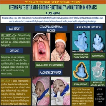 Feeding Plate Obturator fabricated for a neonate.pptx