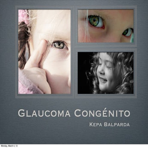 Glaucoma Congénito | PDF
