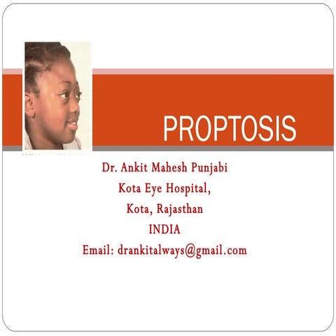 Proptosis | PPT