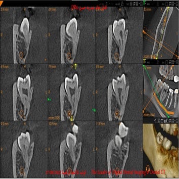 الوليد للاشعة الرقمية,DR8_Part12 (3).pdf