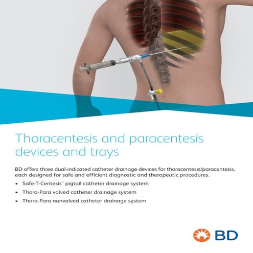 Cook Interventional Radiology Percutaneous Drainage | PDF