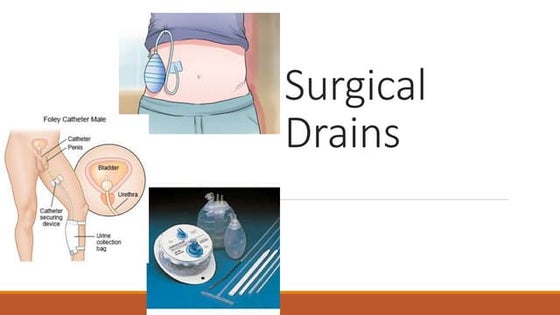Surgical drains | PPTX | First Aid | Injuries