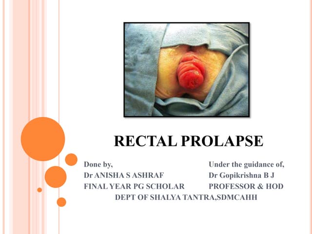 RECTAL PROLAPSE | PPTX