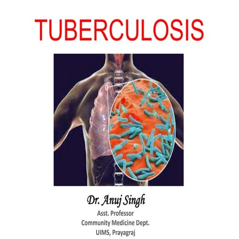 Tuberculosis, epidemilogy, investigation and treatment | PPTX