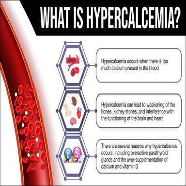 What Is Hypercalcemia? | PPT