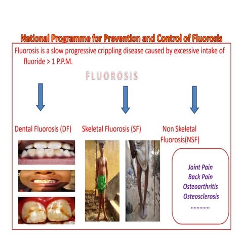 Dr dutta nppcf fluorosis_2nd half | PPTX