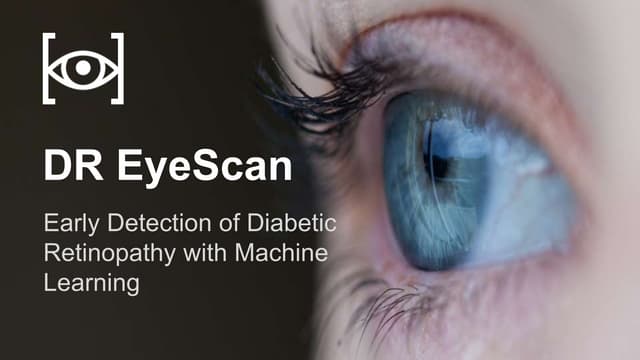 Diabetic Retinopathy Detection Using Cnn Image Classification Algorithm Ppt