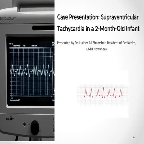 dr haider ali 2.ppt on svt and case study | PPT