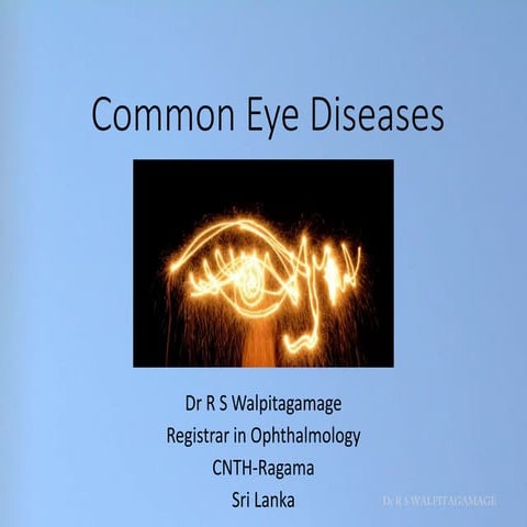 Common Eye Diseases | PPTX