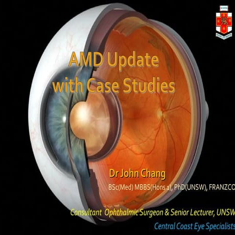 Age Related Macular Degeneration- Update with Case Studies | PPT
