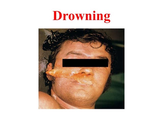 Drowning | PPT