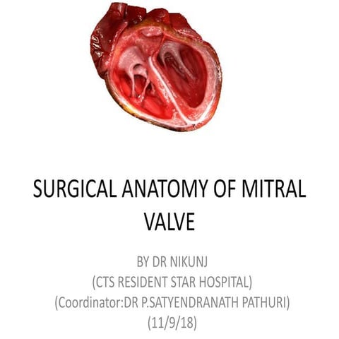 Mitral valve surgical anatomy DR NIKUNJ R SHEKHADA (MBBS ,MS GRN SURG ...