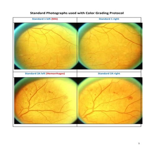 Dr screening training for nurses standard photographs used with color ...