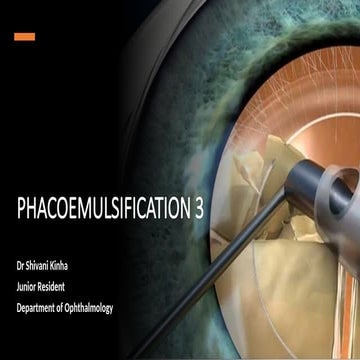Dr shivani Phacoemulsification steps 3.pptx