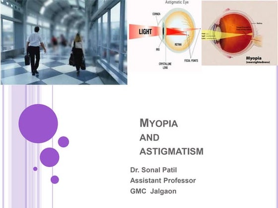 MyopiaMyopia or shortsightedness is a type of refractive error in which ...